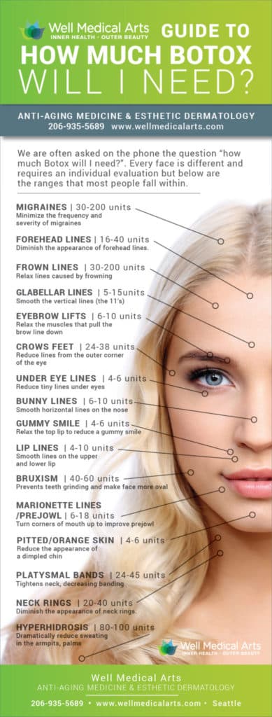 How much Botox do I need? - Well Medical Arts: West Seattle's Medispa ...
